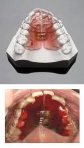 Schwarz - Dr. Sep's London Ontario Practice