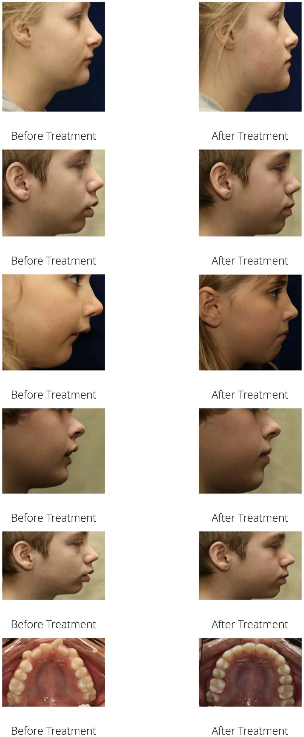 Smile Gallery - Dr. Sep & Dr. Rondeau