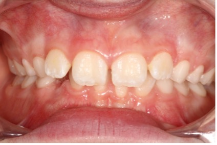 TMJ Therapy FAQs - Dr. Sep's London Ontario Practice